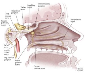 Is the Sphenopalatine Ganglion Block (SPG Block) Right For You ...